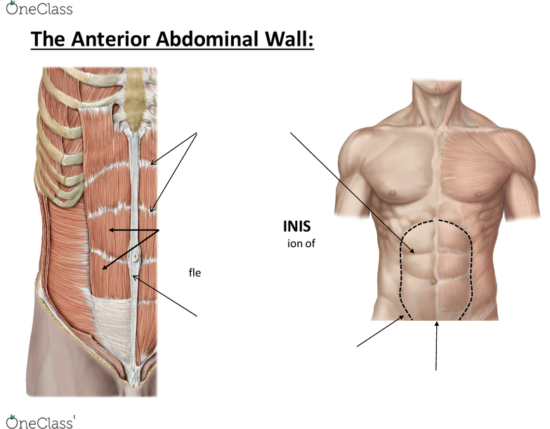 Tendinous Intersection