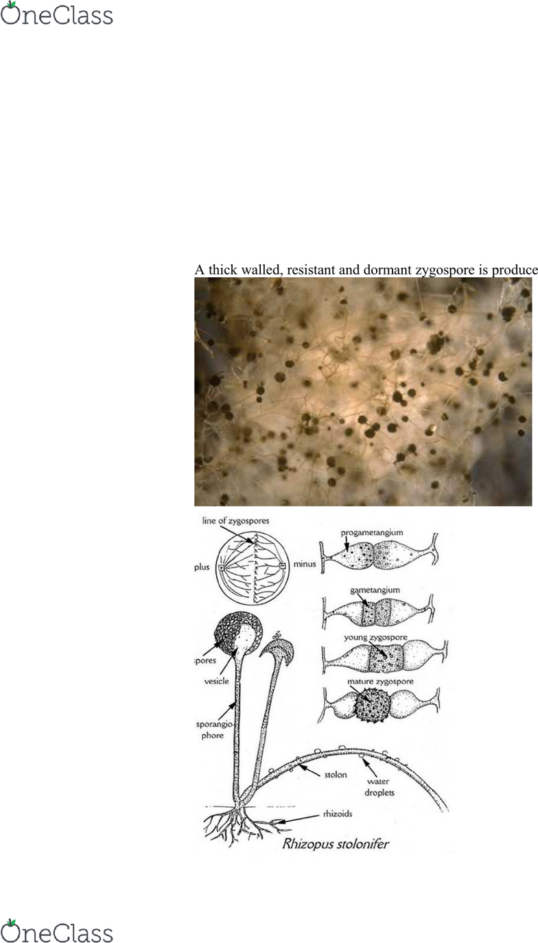 Zygomycota Microscope