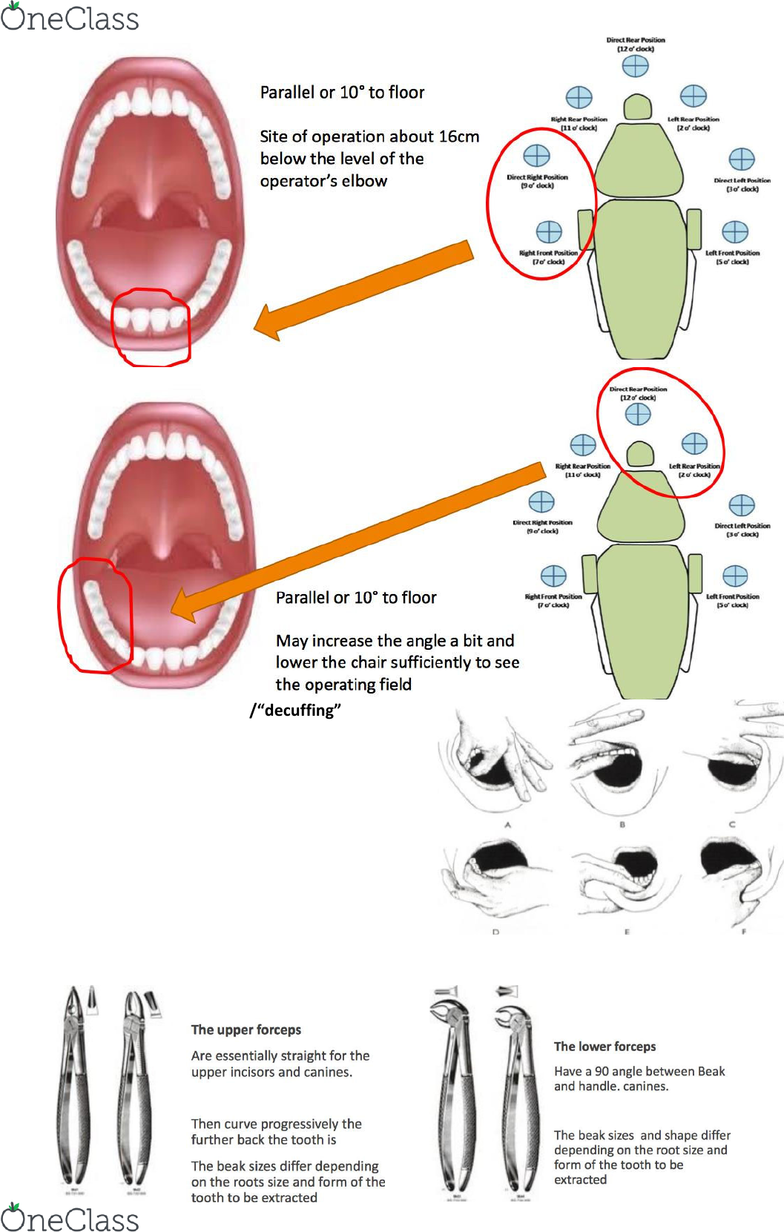 Forceps Position For Maxillary Premolar Extraction MEDizzy, 56% OFF